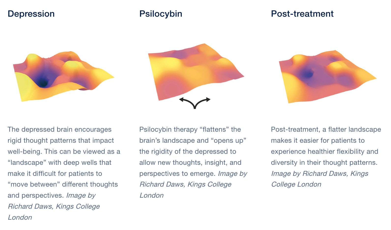 Psilocybin Rewires The Brain For People With Depression University Of 